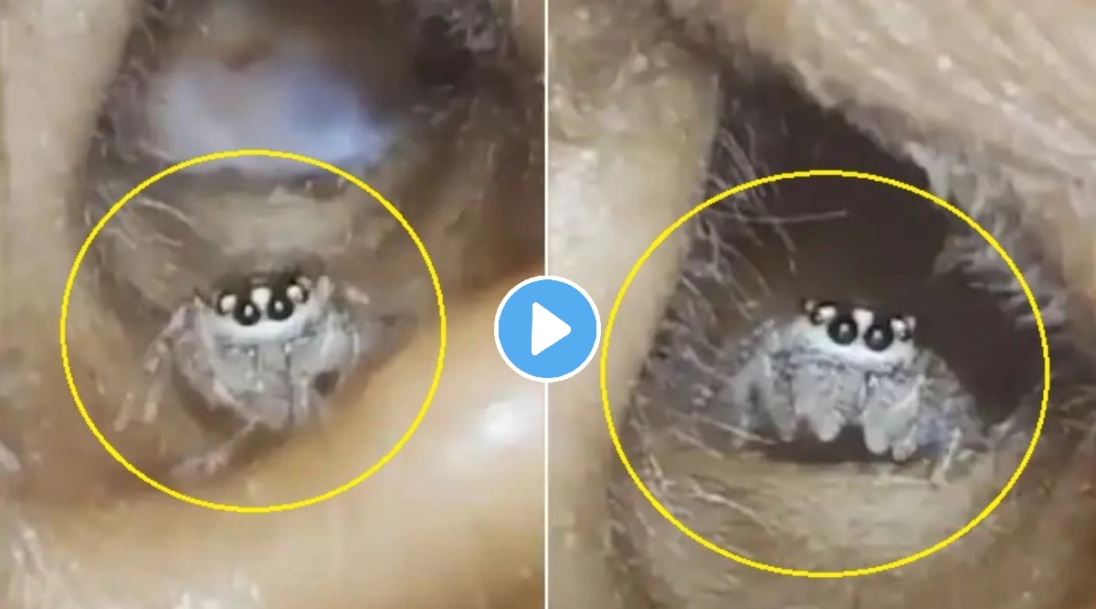 Shocking video of little spider roaming inside the ear of indian woman ...