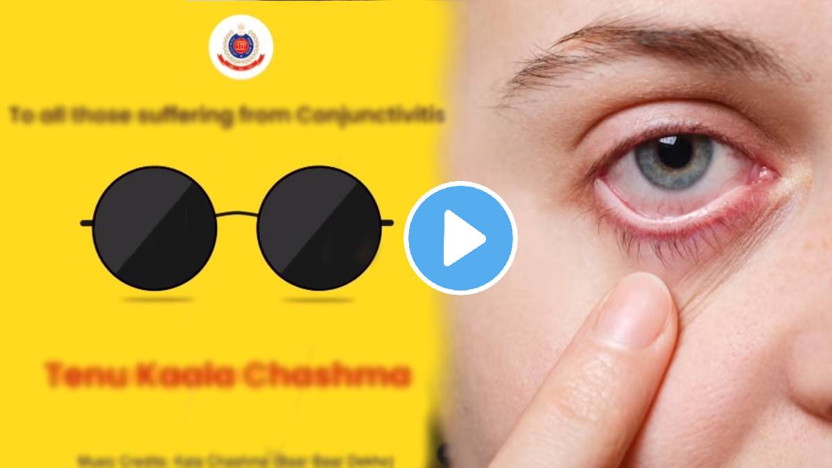conjunctivitis eye flu delhi police also alerts who have red pink eyes try remedy features a ...