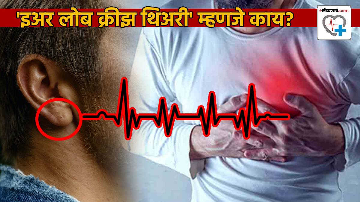 Can heart attacks be predicted with an ear lobe crease Heart Specialist ...