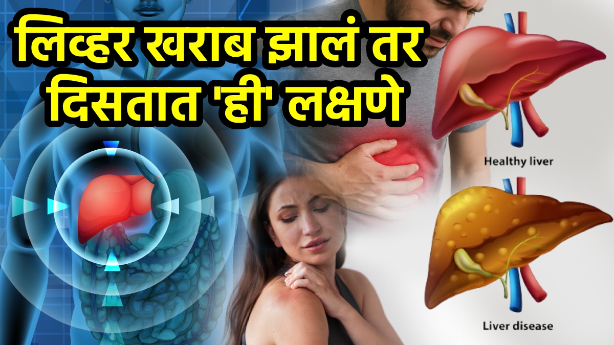 Liver damage symptoms liver disease signs in body food for healthy liver failure symptoms doctor ...