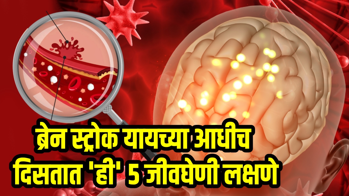Brain Stroke Symptoms early signs of brain strokes in body stroke ...
