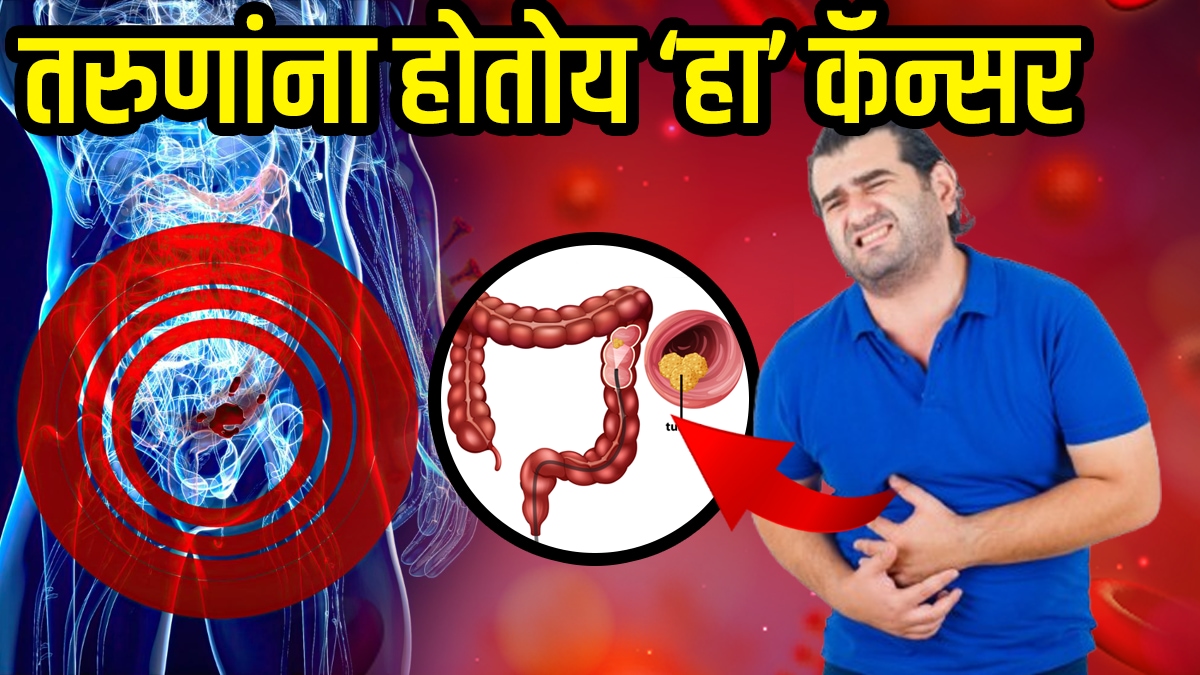 colon cancer symptoms in young and adults colon cancer causes and ...